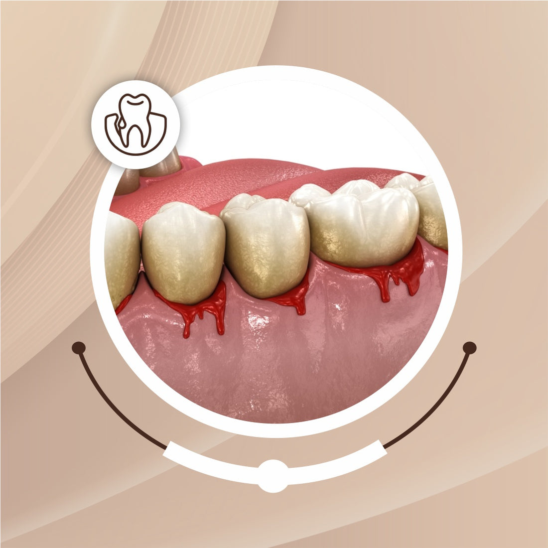 Best Toothpaste for Cavities & Bad Breath in India – Clove Ultimate